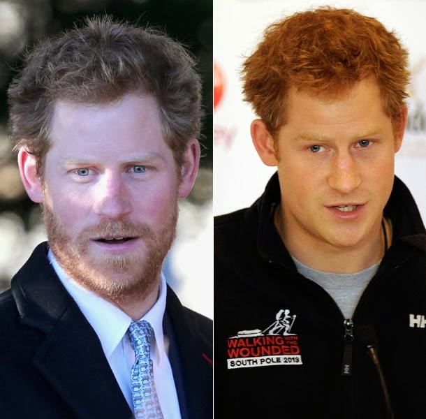 About William and Kate: Prince Harry With or Without the Beard. VOTE ...