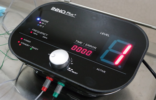 Renewme Skin Clinic: INNO Plus+: The Upgraded RF Procedure for Skin ...