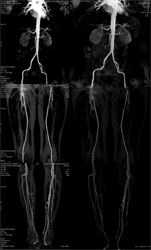 SPIN RADIOGRAPHERS: Contrast-enhanced MR angiography of abdominal aorta ...