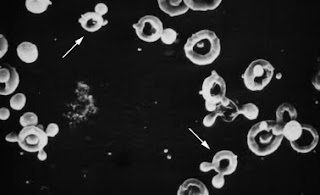 Case of the Day: Mickey Mouse