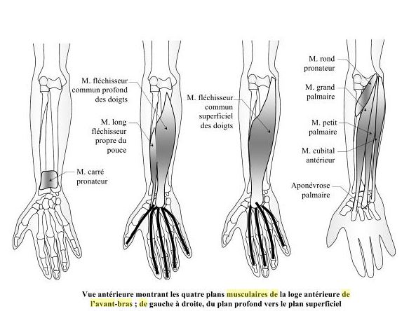 Syndrome des loges avant bras - Christy Blair
