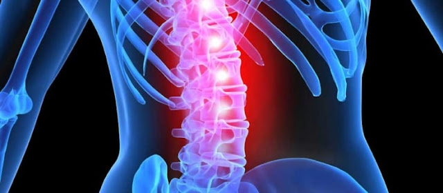 Treatment for Paralysis: Quadriplegia