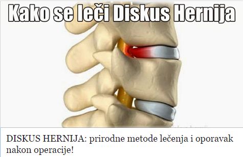 Diskus hernija simptomi i lečenje | Kulinarske Delicije