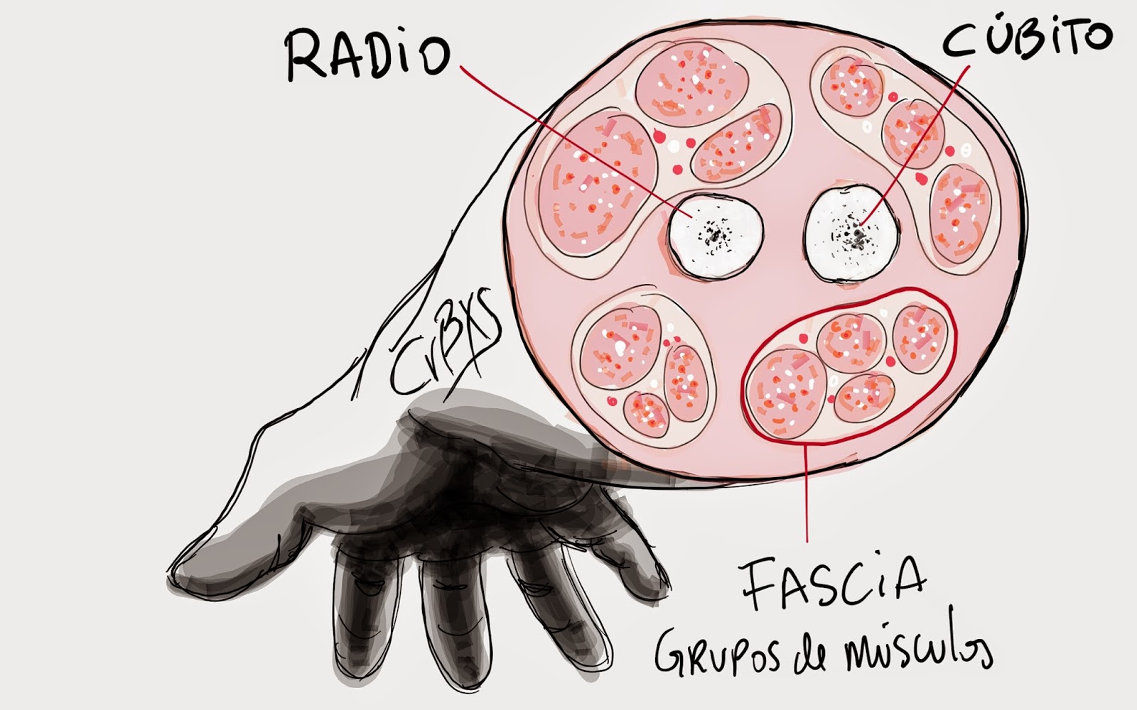 Crónica Boxes: Síndrome Compartimental