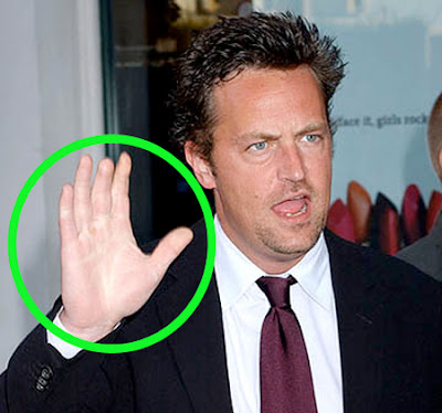 WOW-facts: Actor Matthew Perry is missing part of his middle finger.