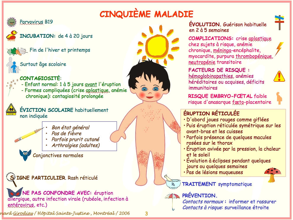 Le Retour de G: La guerre des boutons
