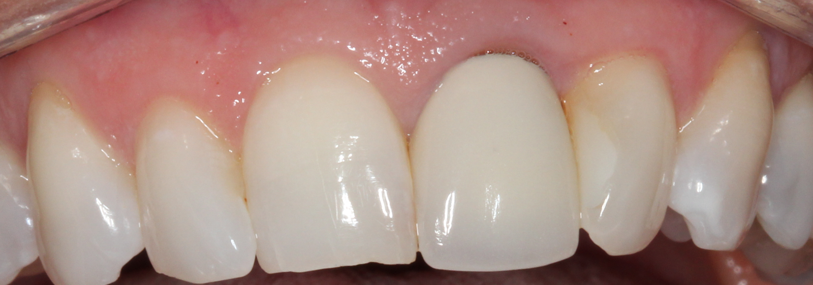 Gregory Dental Group Blog