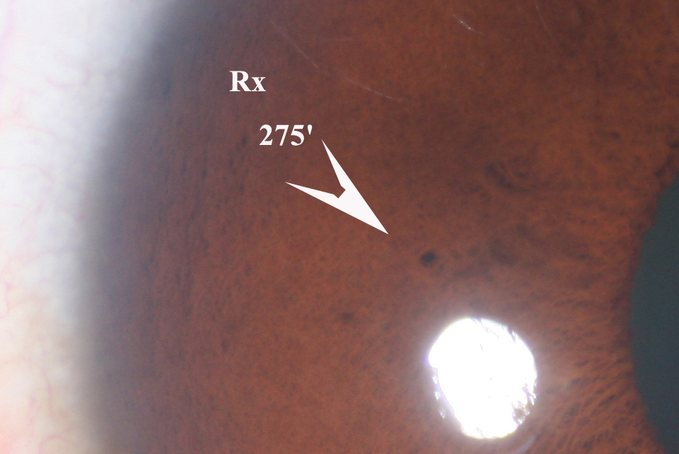 Modern & Multidimensional Iridology: Structural & Stress Signs in Iris ...
