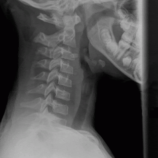 Radiografi C.V Cervicalis