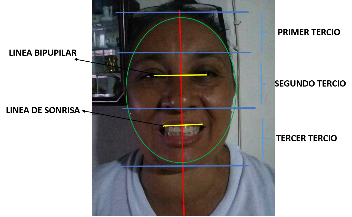 Introducción a la Odontología 2015-ll: ANÁLISIS DE SONRISA