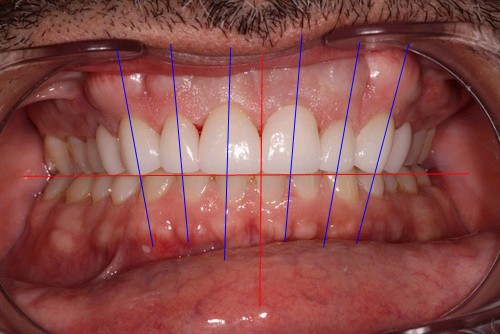 Delivery Visit #4 - Bauer Smiles