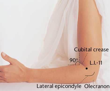 LI 11. Quchi / Ci Ce (Kolam Berliku-liku) - Terapi Jarum