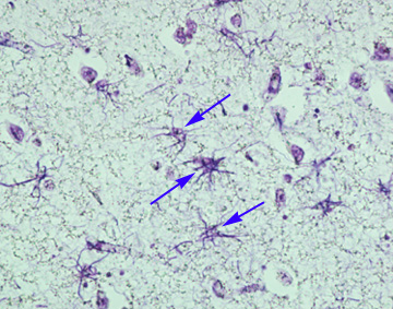 Manash (Subhaditya Edusoft): Subhaditya News Channel Present Latest ...