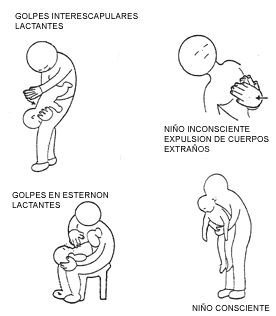 SER MADRE: ¡AUXILIO! ¡SE ASFIXIA MI BEBÉ!