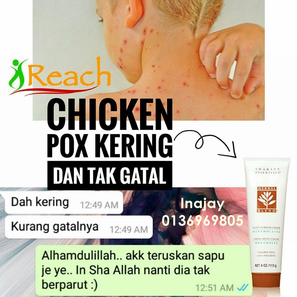 Cara hilangkan parut chicken pox sampai kulit muka boleh licin macam ...