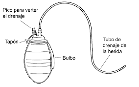 Drenaje quirúrgico Redon y Jackson Pratt: ¿Qué es el drenaje Jackson Pratt?