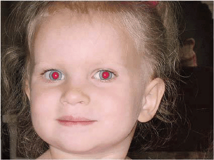 Aplicações Informáticas: Ficha nº15- Correção de olhos vermelhos