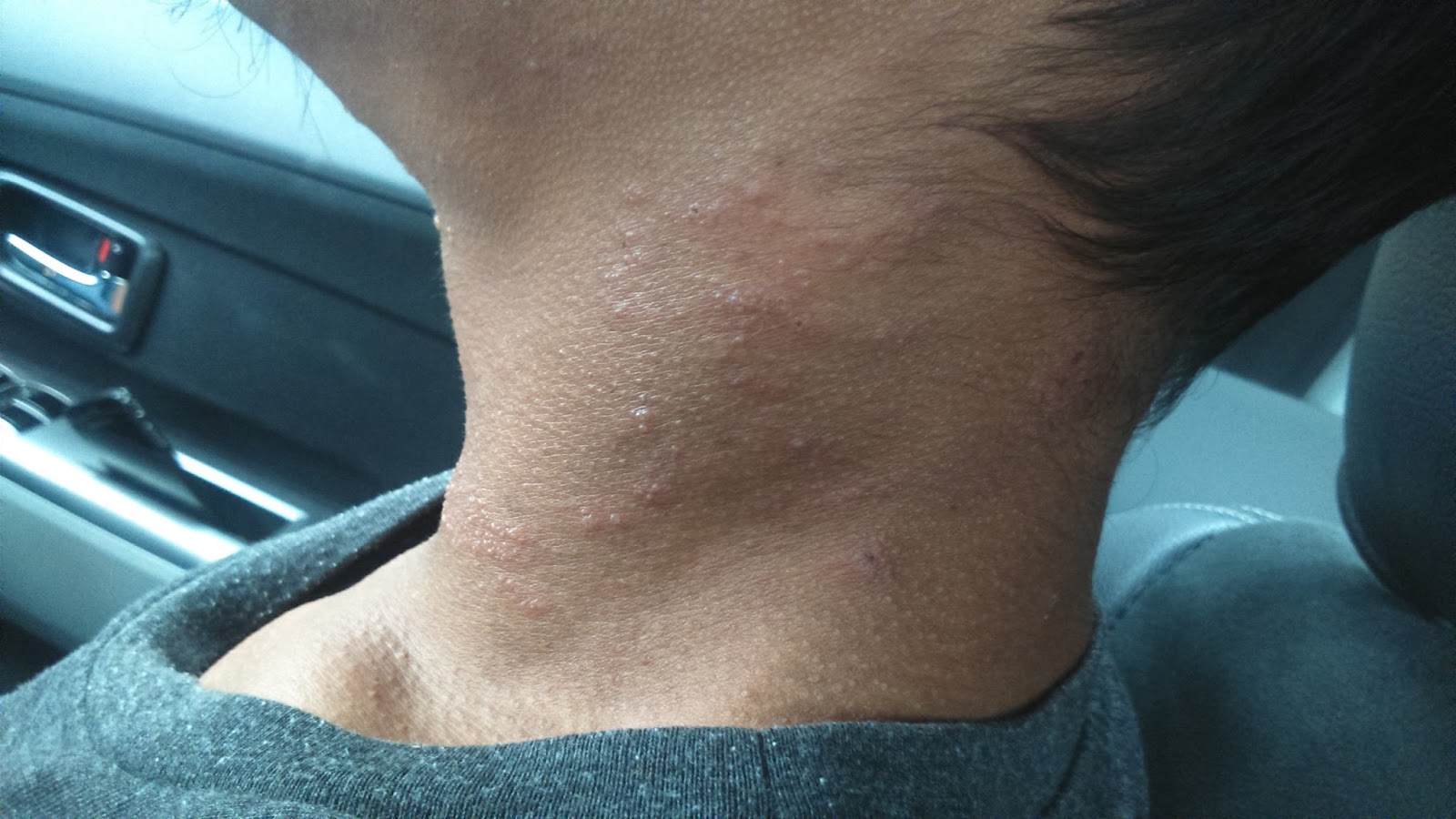 ini belog saya yang punya : KAYAP MENYERANG ORANG KESAYANGAN KITA