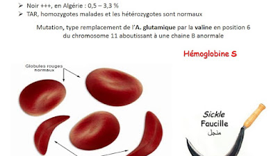 Anémies hémolytiques extra-corpusculaires -Dr.Nechar - Alger ~ COURS de ...