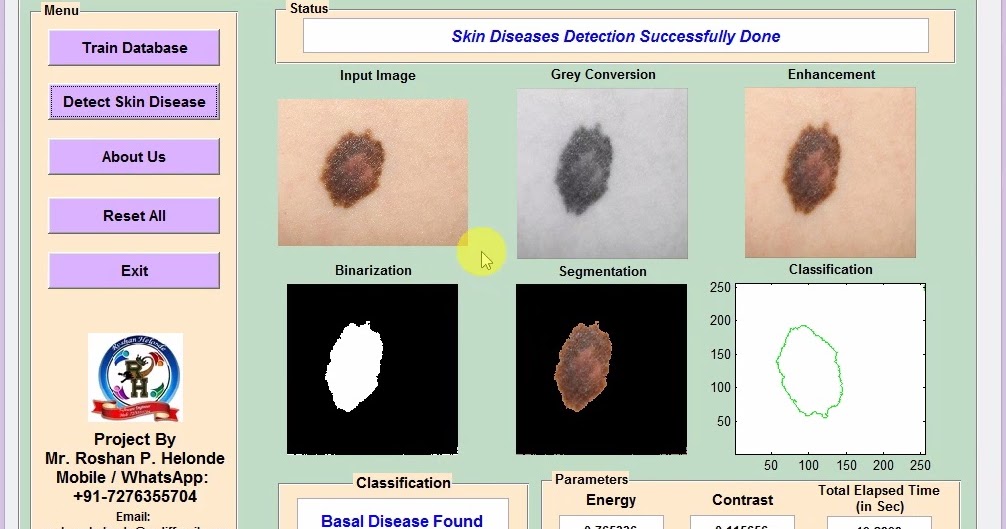 Matlab Project For Skin Disease Detection Using Image Processing Matlab Project Code Ieee Based