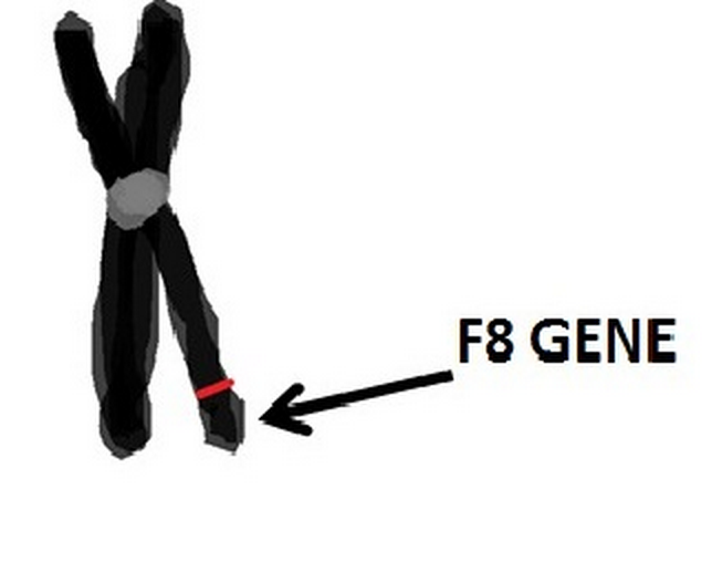 Hemophilia: Coagulation Factor VIII