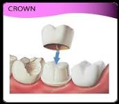 What's the Difference Between a Crown and a Filling?