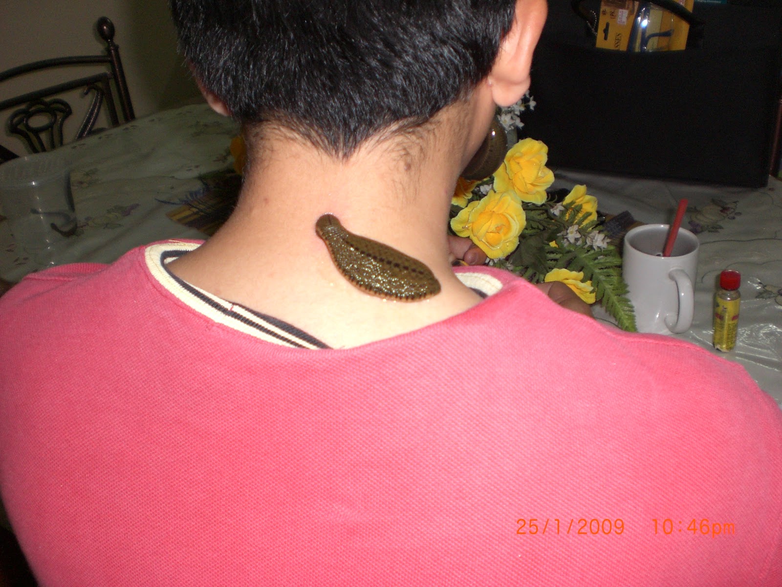 TakeCare!: LEECH THERAPY IN MALAYSIA - Painless Ancient Treatment