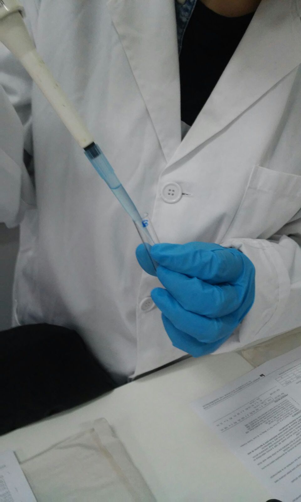 Prácticas Bioquímica: Determinación de urea