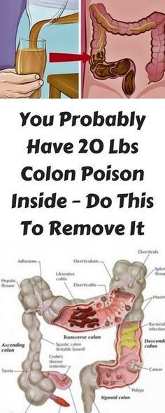 These 2 Homemade Colon Cleanse Recipes Help Eliminate All Deposited ...