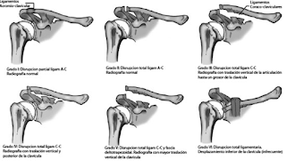 MEDICOBLASTOS FACMED: SIGNO