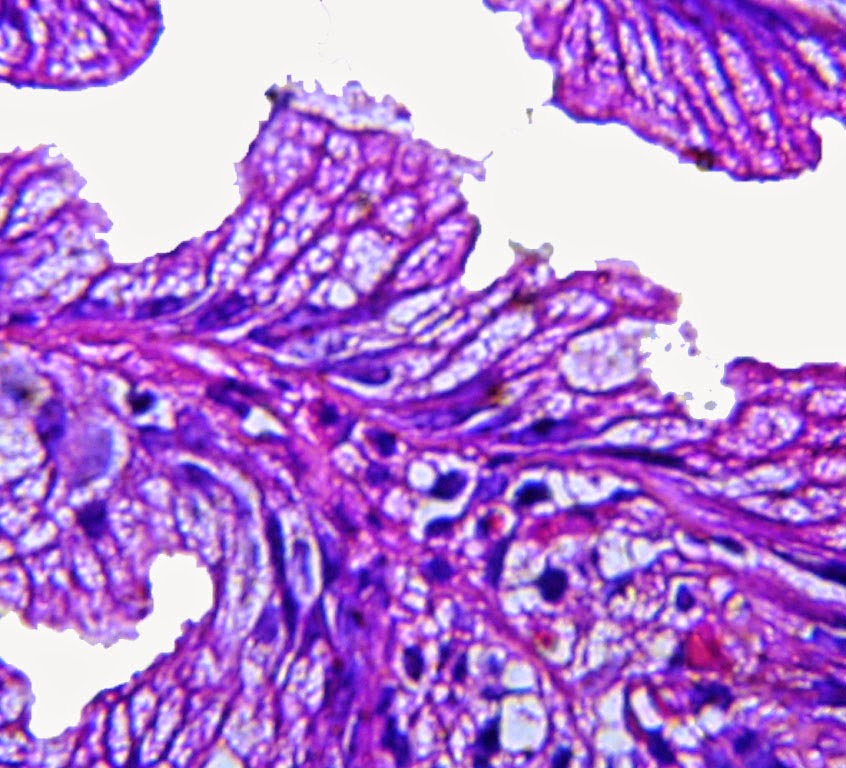 GASTROINTESTINAL AND LIVER HISTOLOGY PATHOLOGY ATLAS: August 2014