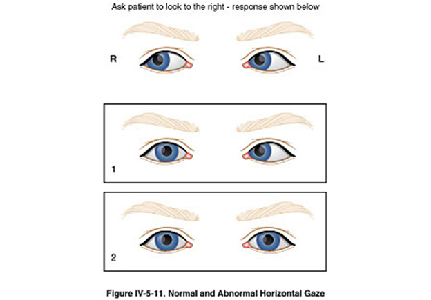 Dentistry and Medicine: Central Nervous System(CNS) -Blood Supply