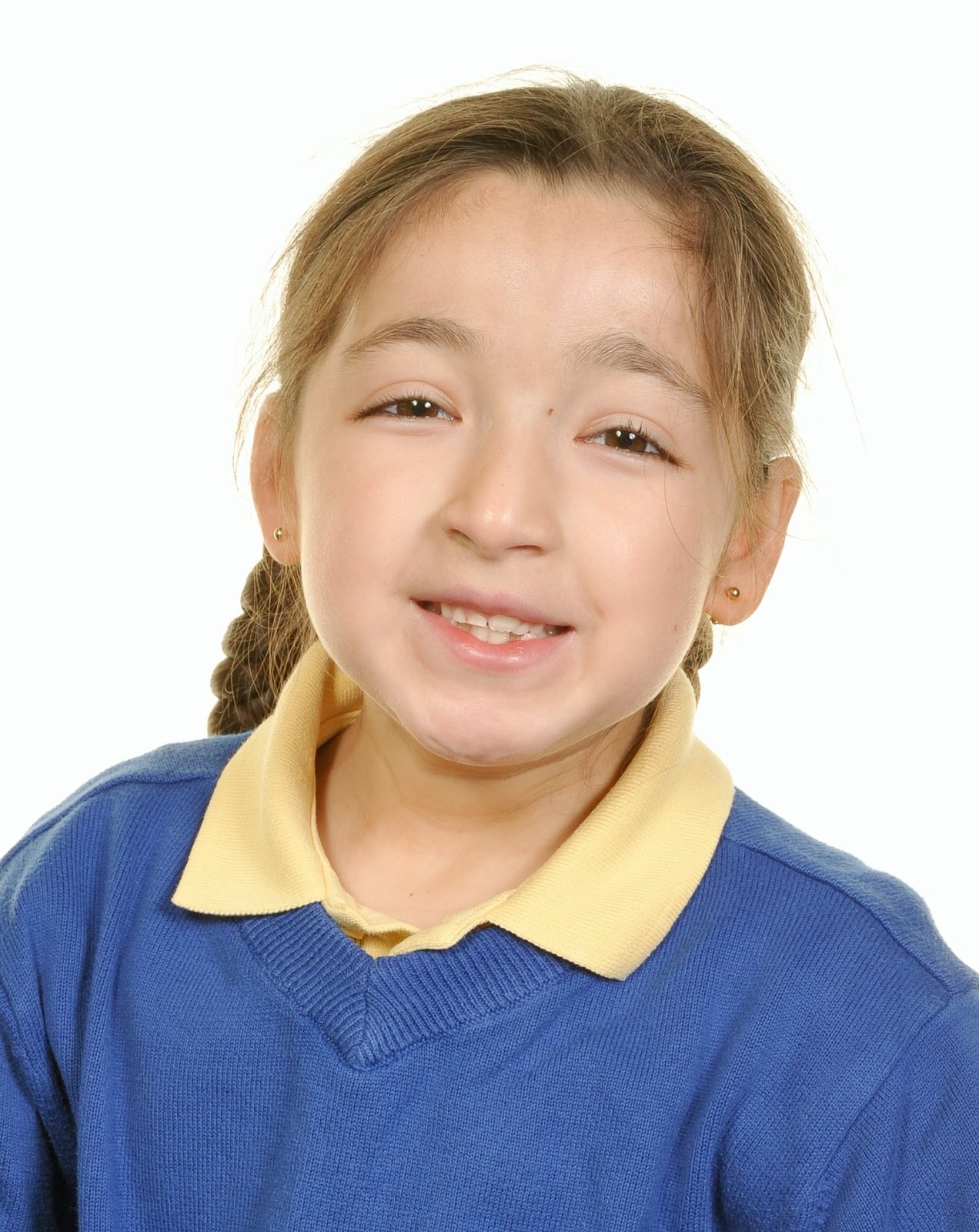 Rubinstein-Taybi Syndrome: November 2017