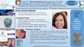 Raynauds Scleroderma Global Patients: The Magic of Summer When Living ...