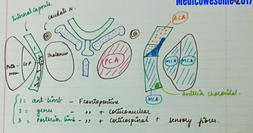 Medicowesome: Lacunar strokes : An Overview