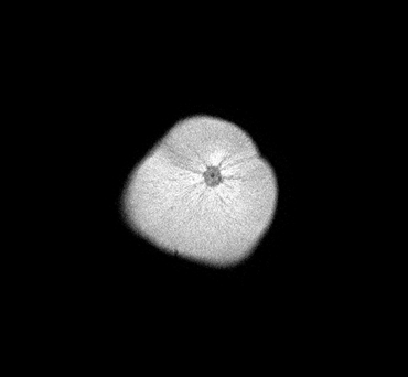 MRI Images of Fruits & Veggies by Andy Ellison | Life in Pictures