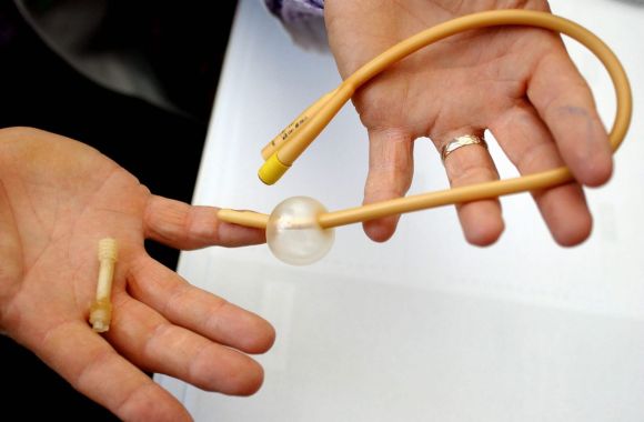 gusti blogs: prosedur kateterisasi