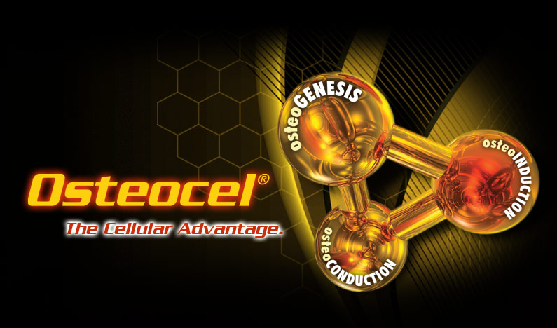 Periodontia e Implantes: Osteocel - mais uma opção de produto com ...