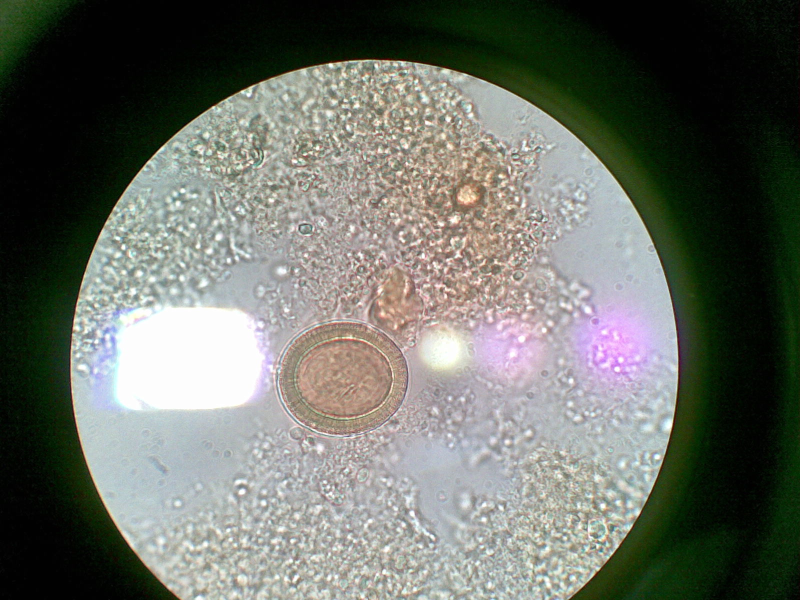 Ca - CaDo (Catatan Calon Dokter): Blok 9 : Praktikum Parasitologi ...