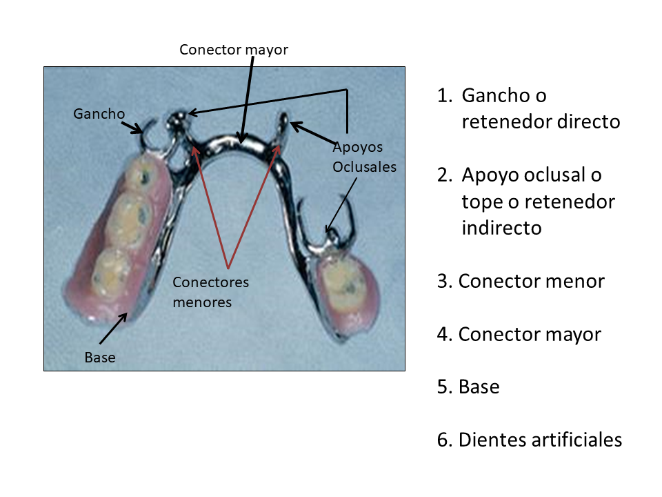 REHABILITACIÓN II : 1° Parcial Elementos PPR, clasif, planos guía ...
