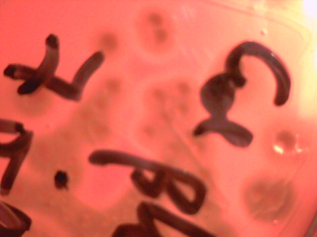 LABORATORIO Y MICROBIOLOGÍA: EJEMPLOS DE BETA HEMÓLISIS.