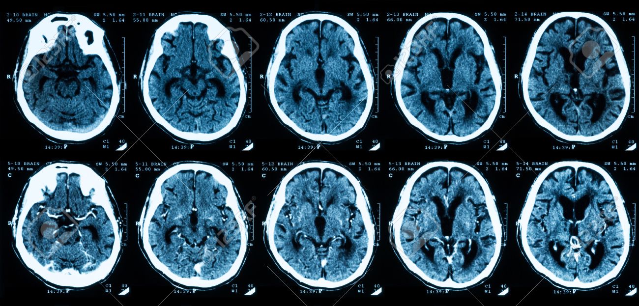Benjamin W. Bass: It's not a toomah... well, it MIGHT be a toomah, but ...
