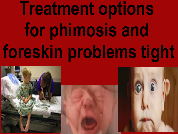 1 of th Best of: Treatment options for phimosis and foreskin problems tight