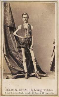 Isaac W Sprague (1841-1887), Living Skeleton. ~ Nigeria:Yesterday,Today ...