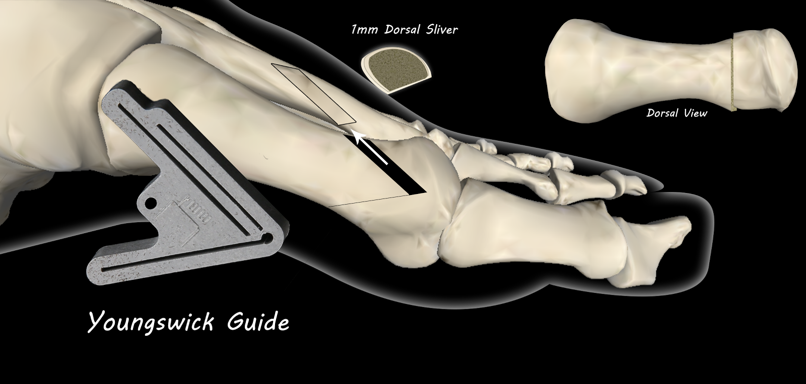 Podo Basas al Día: Podología Deportiva. Campeonato del Mundo Sub 20 en ...