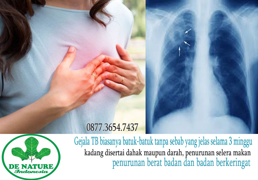 OBAT PENYAKIT TBC PARU