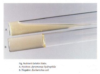 Gelatin Hydrolysis Test | Principle, Uses, Media, Procedure and Result ...