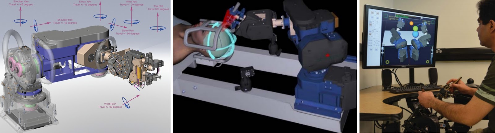 The neuroArm - SYMBIS robot