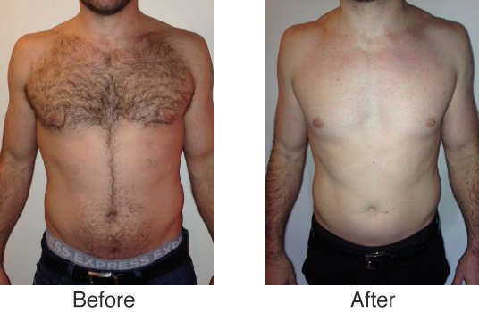 Best quotes for you: To Shave or Not: The Basics of Chest Hair Removal