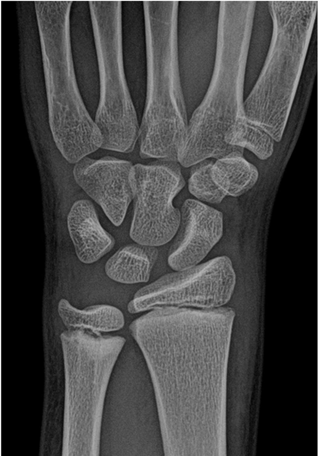 RADIOLOGIA RIBEIRO: PUNHO P.A. + PERFIL